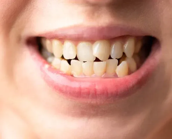 Common Cosmetic Dental Problems and Their Proven Solutions