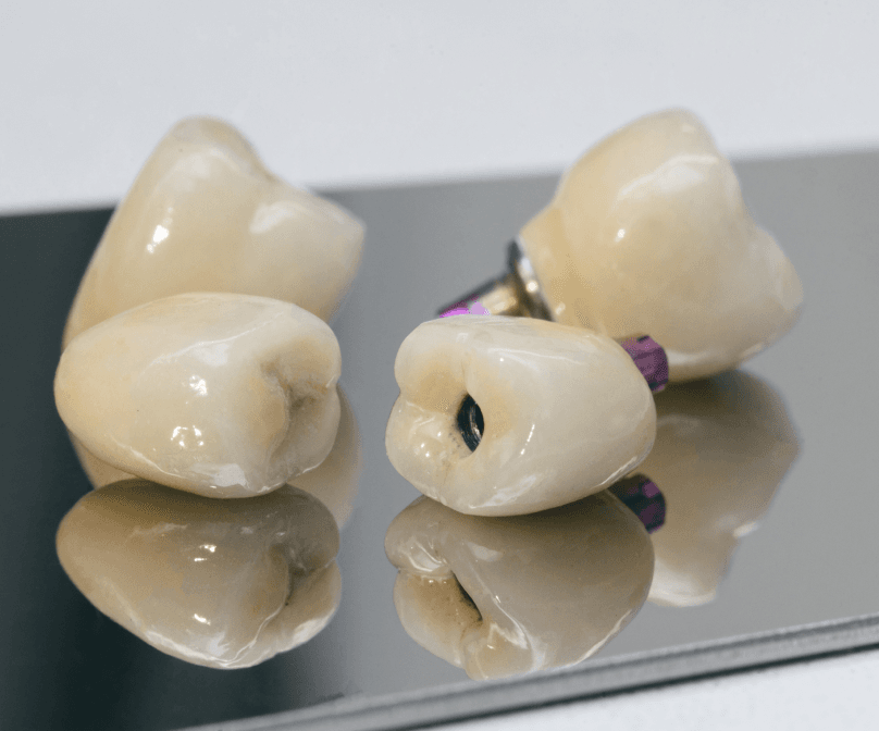 Dental Crowns San Francisco | Same-Day Crowns