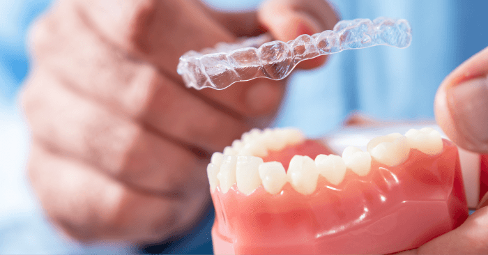 Invisalign San Francisco | Invisalign Dentist For Adults